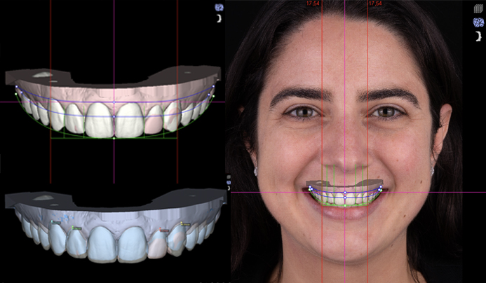 Unlocking Your Smile: How a Facial Dentist Enhances Your Features ...