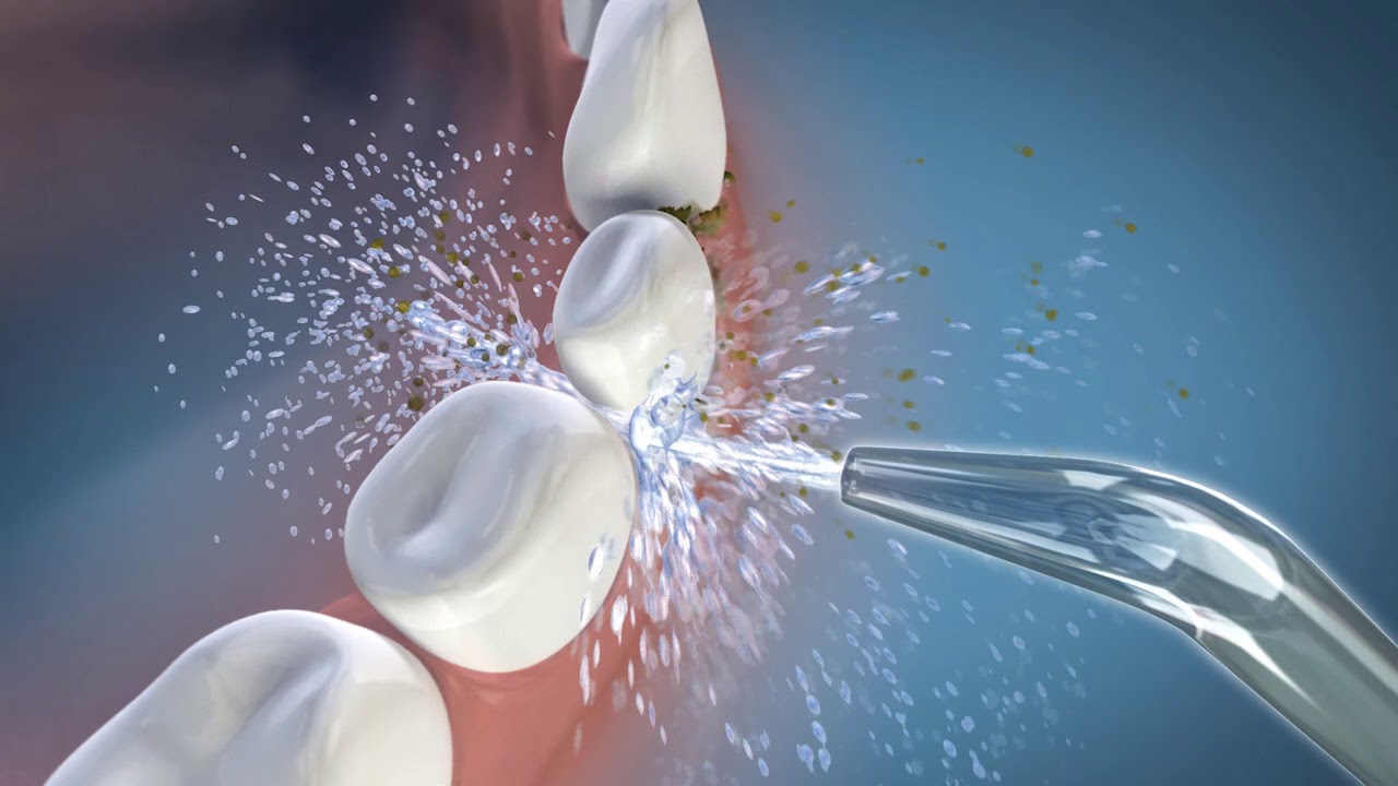 Water Flossers: Are They Worth the Hype? - Healthy Teeth Experts